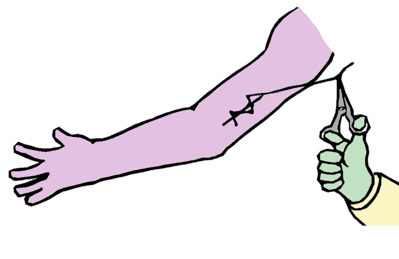 Quia - Treatments